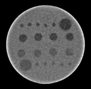 Image Quality Metrics | Oncology Medical Physics