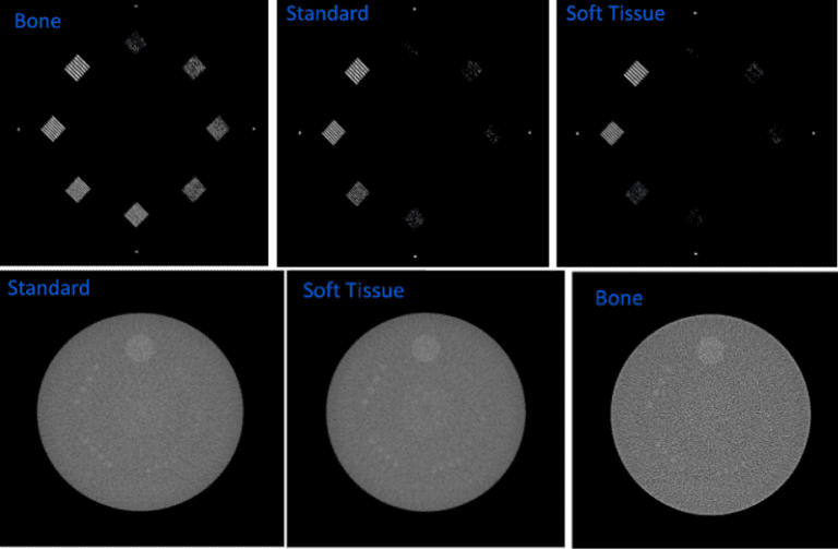 CT Design and Operation | Oncology Medical Physics
