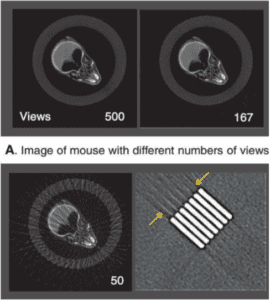 CT Artifacts | Oncology Medical Physics