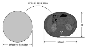 CT Dosimetry | OncologyMedicalPhysics.com