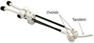 Gynecological Brachytherapy | OncologyMedicalPhysics.com