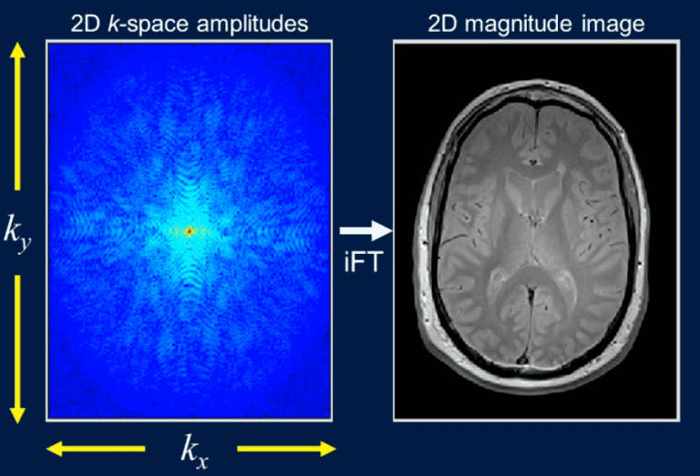 MRI Design and Operation | Oncology Medical Physics