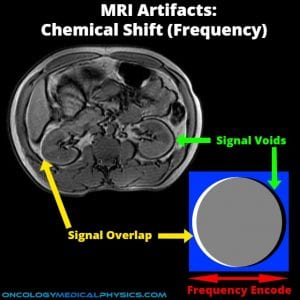 MRI Artifacts | OncologyMedicalPhysics.com
