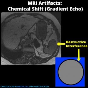MRI Artifacts | OncologyMedicalPhysics.com