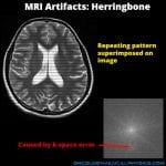 MRI Artifacts | Oncology Medical Physics