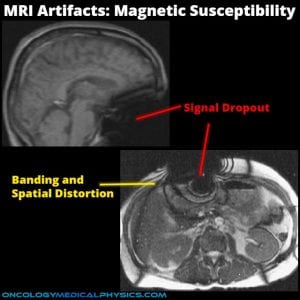 MRI Artifacts | Oncology Medical Physics