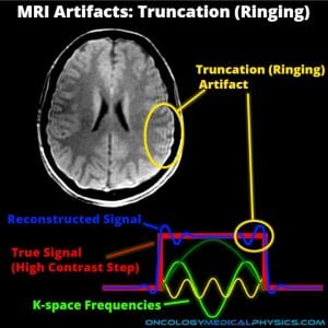 MRI Artifacts_ Truncation – Oncology Medical Physics