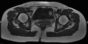 Magnetic Resonance Imaging | Oncology Medical Physics