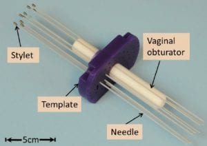 Gynecological Brachytherapy | Oncology Medical Physics