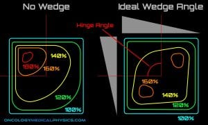 Basic Photon Treatment Planning | Oncology Medical Physics