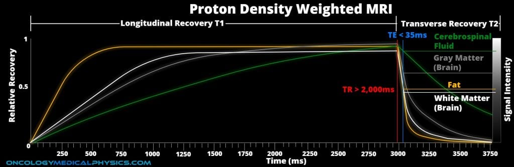 MRI Contrast Weighting | Oncology Medical Physics
