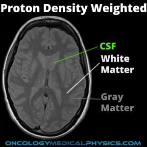 MRI Contrast Weighting | Oncology Medical Physics