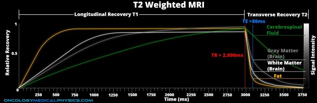 MRI Contrast Weighting | Oncology Medical Physics
