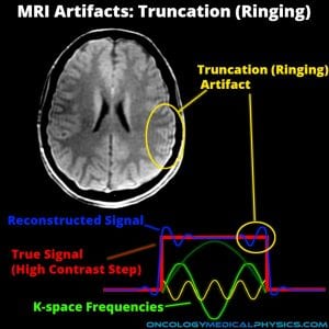 MRI Artifacts | Oncology Medical Physics