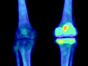 Nuclear Tomographic Imaging | Oncology Medical Physics