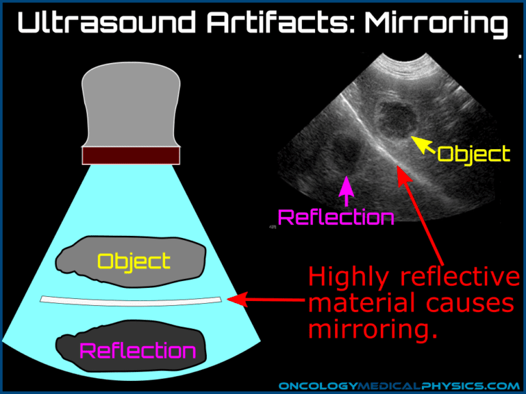 Ultrasound Artifacts | OncologyMedicalPhysics.com