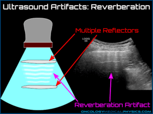 Ultrasound Artifacts | Oncology Medical Physics