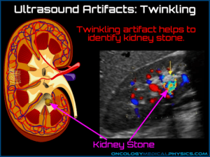 Ultrasound Artifacts | Oncology Medical Physics