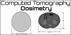 CT Artifacts | Oncology Medical Physics
