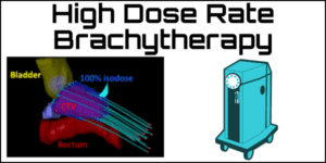 Brachytherapy | Oncology Medical Physics