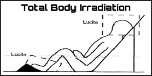 Disease Specific Radiotherapy | Oncology Medical Physics