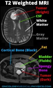 MRI Contrast Weighting | Oncology Medical Physics