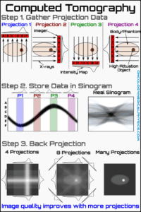 CT Design and Operation | Oncology Medical Physics