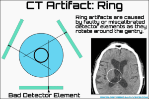 CT Artifacts | Oncology Medical Physics