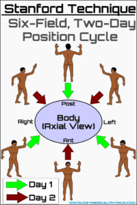 Total Skin Electron Therapy | Oncology Medical Physics
