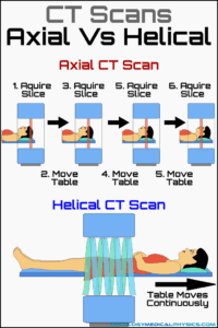 CT Design and Operation | Oncology Medical Physics